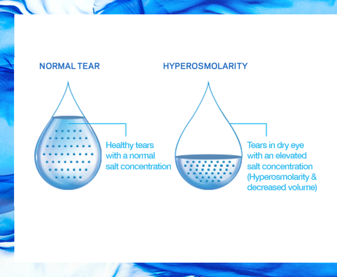 Hydrating Your Eyes TheraTears Hydrating Your Eyes TheraTears